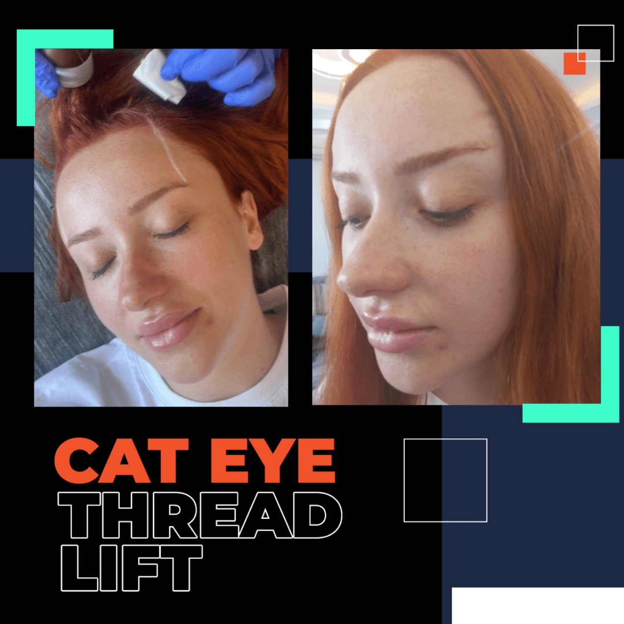 Home - Medical Grace Bodrum Aesthetics